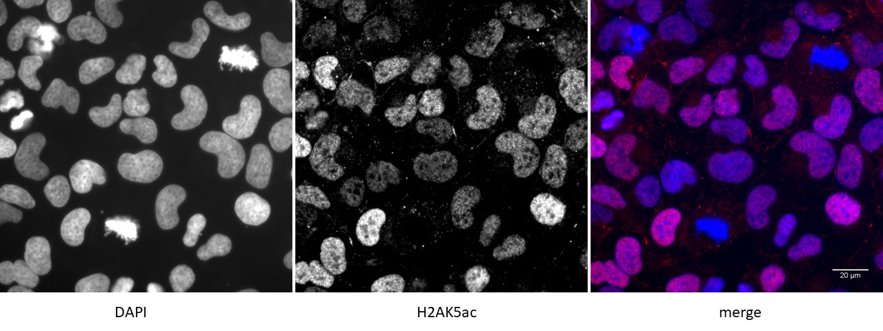 Anti Human Histone H2ak5ac Polyclonal Antibody For Analysis Of Histone Acetylation By Western Blot